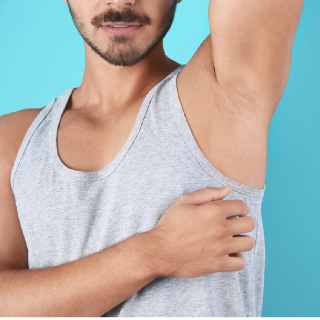 Excessive Sweating Treatment for the Body - New Medical Spa