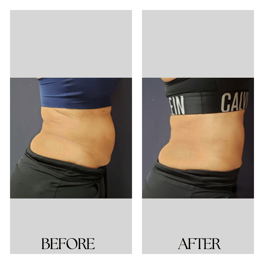 Muscle Tone Advanced Treatments - New Medical Spa